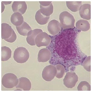 @Nãotemmaisfim@: Mielócitos